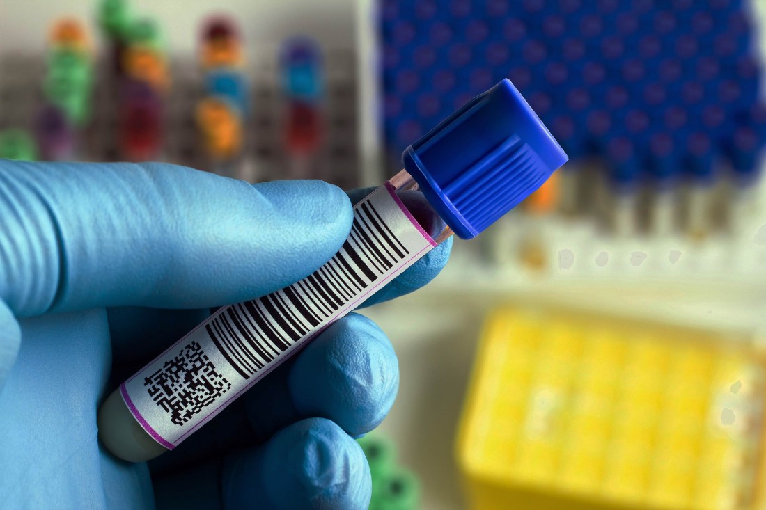 Why Cryogenic Labels are Vital for Biomedical Storage | CYBRA